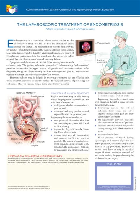 Laparoscopy Endometriosis Specific Local Predictors That Reflect The