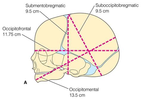 Ob Exam 2 Flashcards Quizlet