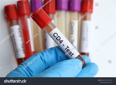 Cd4 Test Look Abnormalities Blood Blood Stock Photo 2227317413 Shutterstock