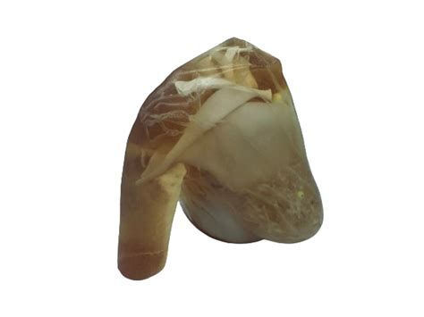 Erler Zimmer Breast Phantom For Mammography And Breast Tomosynthesis