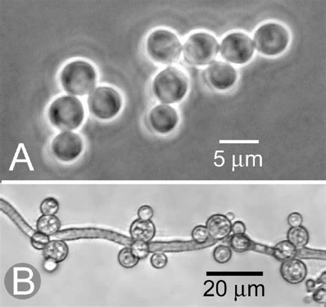 Phase Contrast Photomicrographs Of Vegetative Cells A And