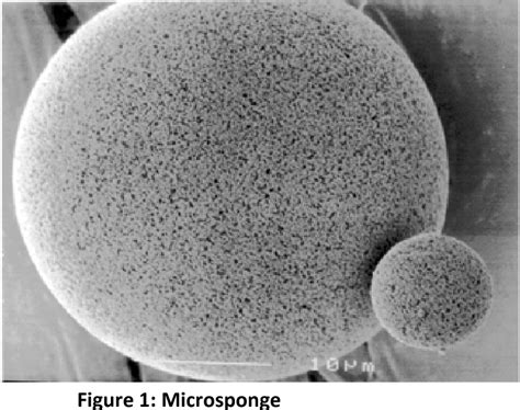 Figure 1 From Microsponges A Novel Drug Delivery System Semantic