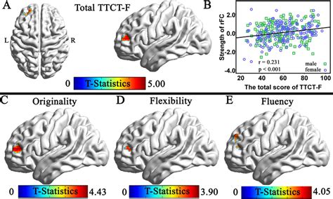 A Region Of Correlation Between The Strength Of Rsfc With The Right