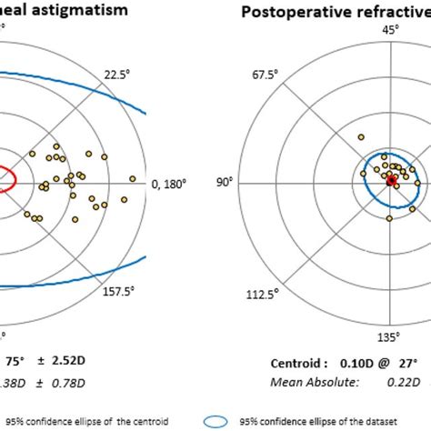 Alignment Of The Toric Iol Using The Digital Marking System Screenshot
