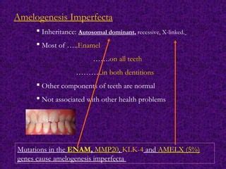 Oral Developmental Anomalies Ppt
