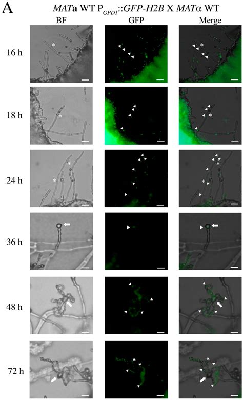 Sexual Differentiation Is Coordinately Regulated By Cryptococcus