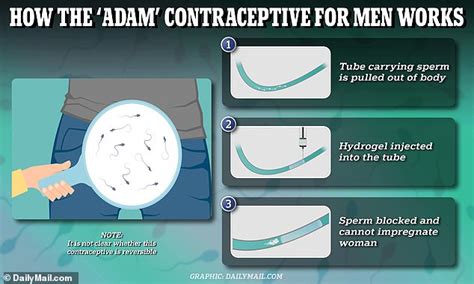 The Iud For Men Is 100 Per Cent Effective At Blocking Sperm For Two