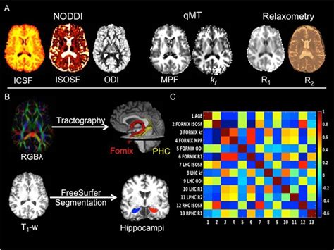 A Mri Modalities And Maps Acquired From Dual Shell High Angular Download Scientific Diagram