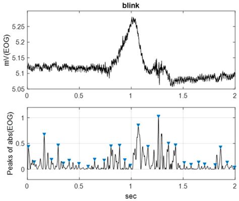 A Wireless Electrooculogram Eog Wearable Using Conductive Fiber Electrode
