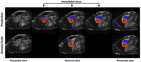 Nisf Neural Implicit Segmentation Functions Myriad