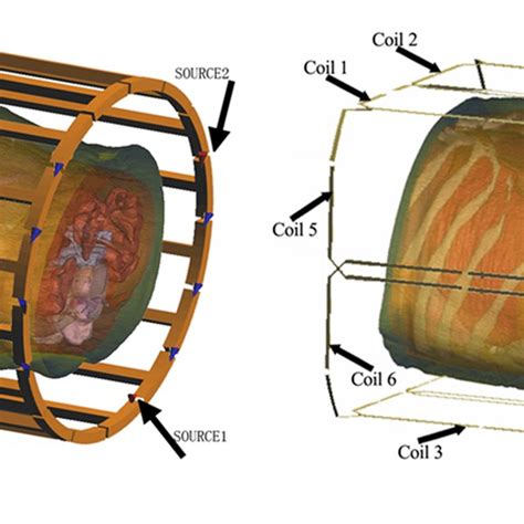 The 16 Leg High Pass Body Coil And The Eight Element Receive Phased Download Scientific Diagram