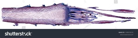 Moss Archegonium Cross Section Cut Under 스톡 사진 1189570210 Shutterstock