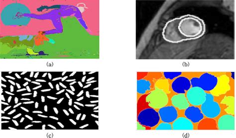 Figure 1 From Efficient Image Segmentation Algorithm Based On Improved