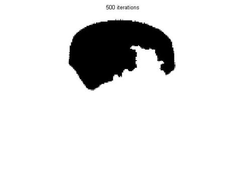11 the evolution of level set function a after 50 iterations b