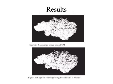 Intelligent Fuzzy System Based Dermoscopic Segmentation For Melanoma Detection Ppt