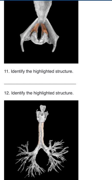 Solved 11 Identify The Highlighted Structure 12 Identify