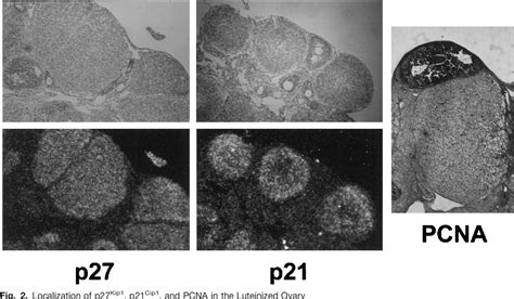 Figure 2 From Hormone Induced Proliferation And Differentiation Of