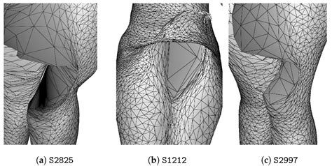 Human Body Shapes Anomaly Detection And Classification Using Persistent Homology