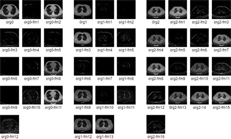 Illustration Of 3 Original Images With Resultant Feature Maps Of Ct