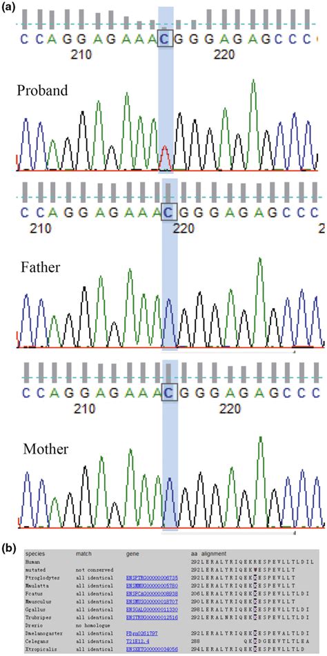 De Novo Dync1h1 Mutation Causes Infantile Developmental And Epileptic