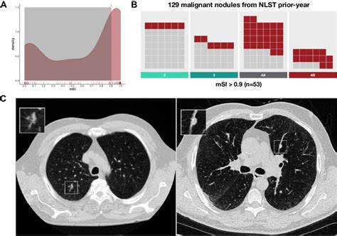 Performance In Prior Year Scans In The National Lung Screening Trial