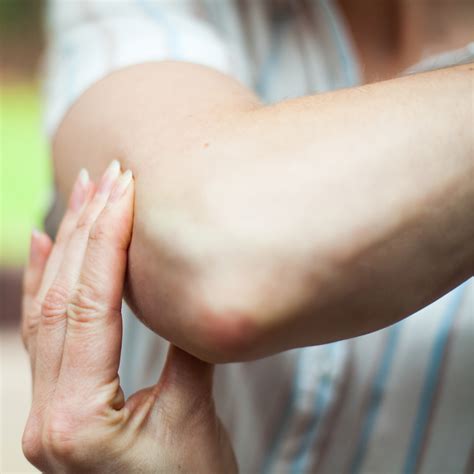 Dislocated Elbow