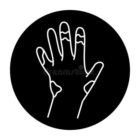 Scleroderma Stock Illustrations 420 Scleroderma Stock Illustrations Vectors And Clipart