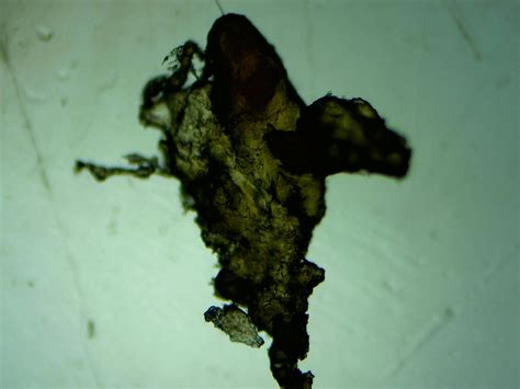 Blackhead Under Microscope By Pr0teusunbound On Deviantart