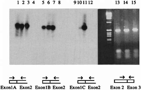 Tissue Specific Expression Of The 5 Exons Rna From Artery Lanes 1 5 Download Scientific