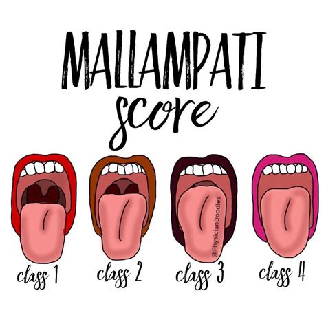Mallampati Score