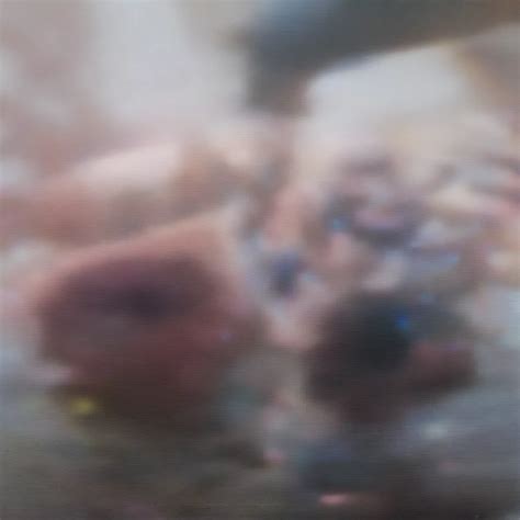 Melanoma And Braf An In Depth Analysis Of Mutations