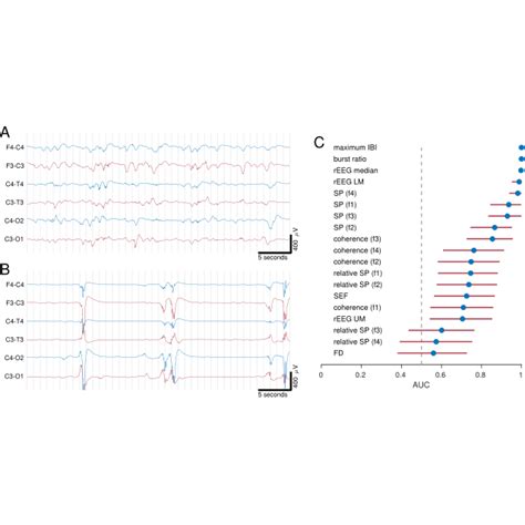 Procedure For Generating Qeeg From Continuous Eeg Download