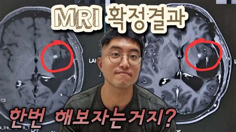 암환자 브이로그 의지를 불태워볼까 Youtube