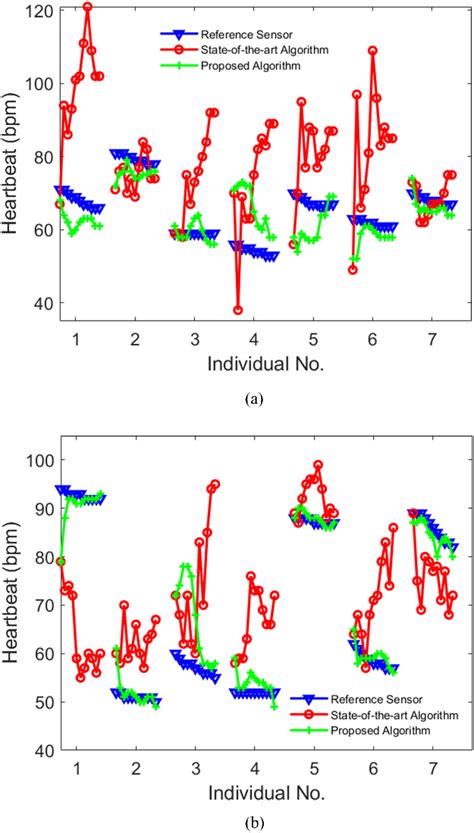 Figure 1 From Improved Contactless Heartbeat Estimation In Fmcw Radar Via Kalman Filter Tracking