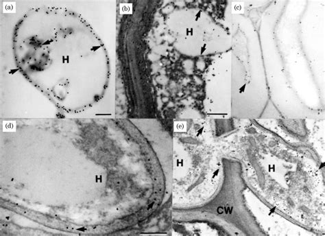 Localization Of Pnl On Invading Hyphae At Early Stages Of Infection Download Scientific