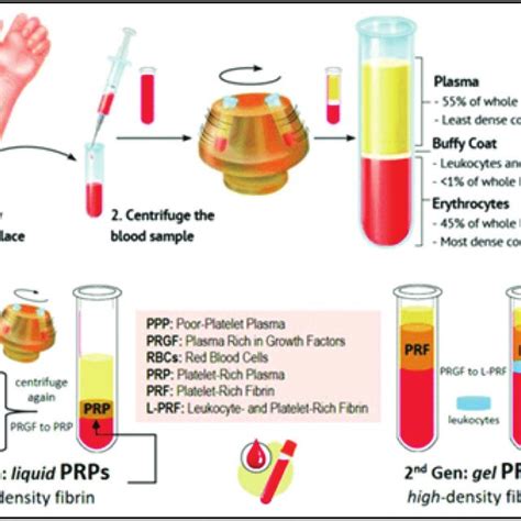 Platelet Concentrates Courtesy Download Scientific Diagram