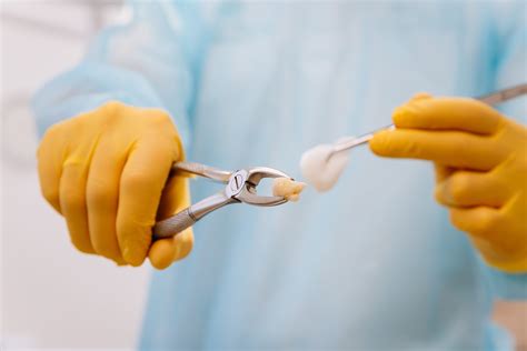 Healing After Tooth Extraction A Guide To Smooth Recovery