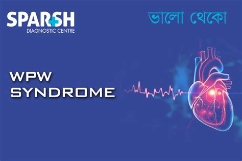 Wolffparkinsonwhite Wpw Syndrome Causes Symptoms Diagnosis And