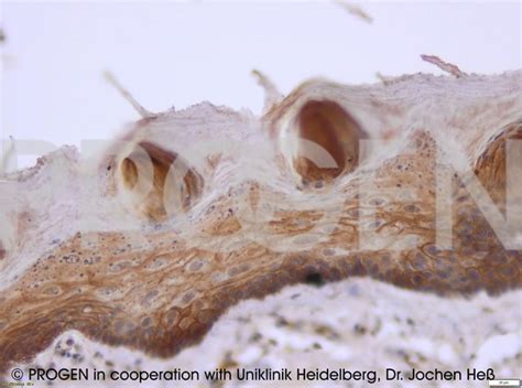 Plakoglobin Monoclonal Antibody Pg 51 Progen 200 μl Unconjugated