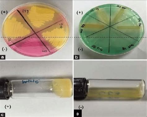 Screening Tests For Identification Of Staphylococcus Aureus From Download Scientific Diagram