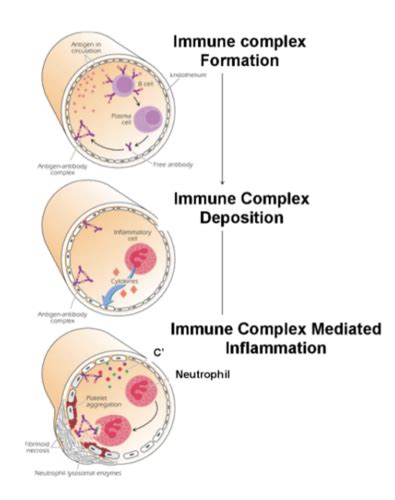 Type Ii And Type Iii Hypersensitivity Flashcards Quizlet