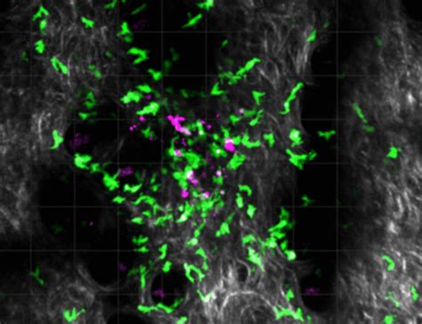 Cd4 T Cells Contribute To Antitumor Immunity By Bawden Et Al Hung Trinh Posted On The Topic