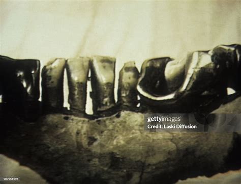 Hitlers Jawbone Is Kept At The Federal Security Service Of The News