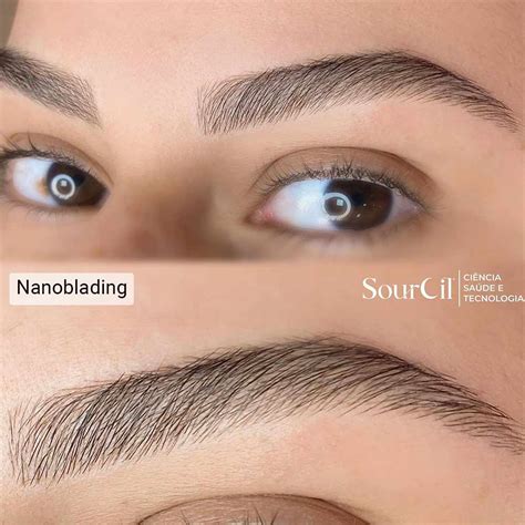 Nanoblading Vs Microblading Key Differences