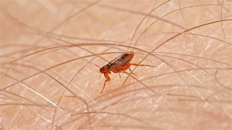 Flea Borne Typhus Disease Spreads To Long Beach Long Beach Local News