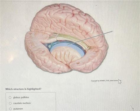 Answered Which Structure Is Highlighted O Globus Pallidus Caudate