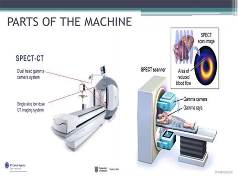 Spect Scan Pptx