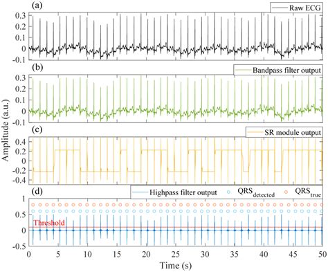 Robust Qrs Complex Detection In Noisy Electrocardiogram Based On Underdamped Periodic Stochastic