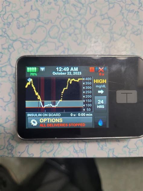 Omnipod 5 Vs Omnipod Dash Plus Looping Aaps Rdiabetest1