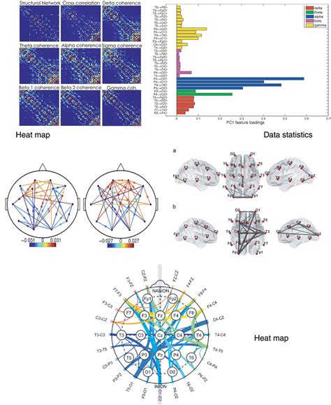 Examples Of The Visualization Of Brain Connectivity A Structural And